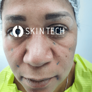 RRS HA LongLasting – LoLa the Skinbuilder